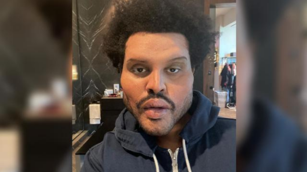 ¿Demasiado botox? Mira cómo luce The Weeknd con su transformación